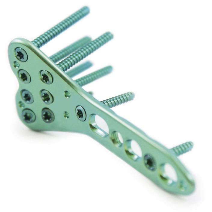 Radius compression plate - 4.0ChLP - ChM - distal / metallic