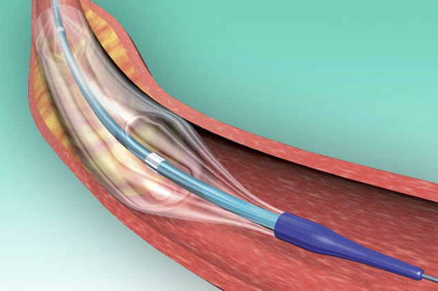 PTCA catheter - POWERLINE™ - Biosensors International - coronary ...