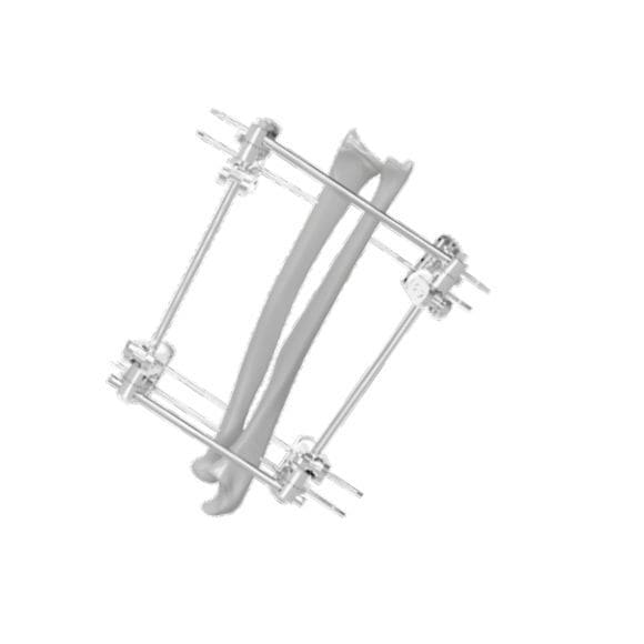 Tibia external fixation system - 201551 - SOFEMED International ...