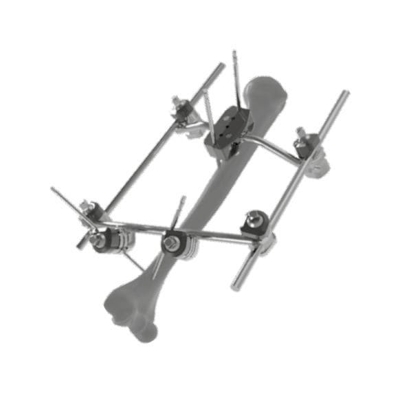 Humerus external fixation system - 206305 - SOFEMED International ...