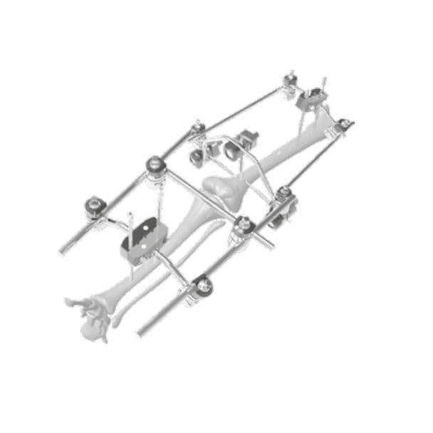 Knee external fixation system - 206310 - SOFEMED International ...