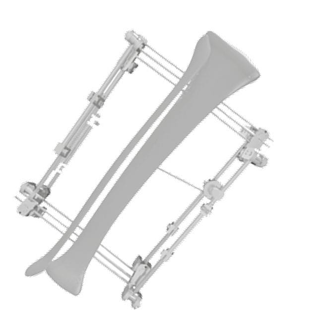 Tibia external fixation system - 201521 - SOFEMED International ...