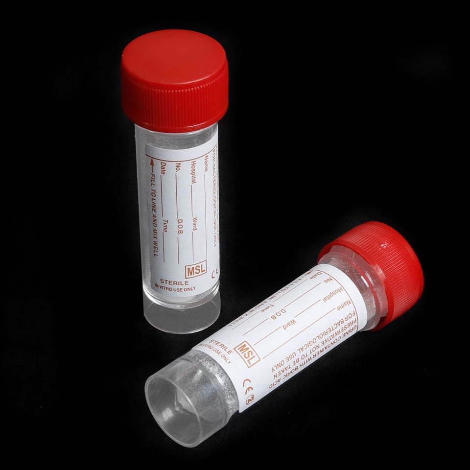 Transport container - 409202BP - Medline Scientific - urine ...