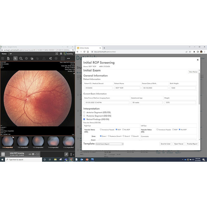 Clinical software - DataLink - Natus Medical - pediatric ...
