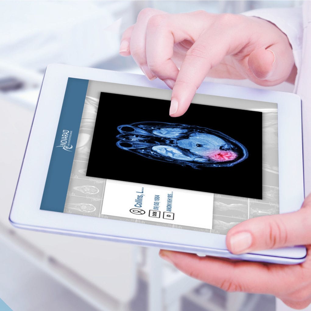 Diagnostic software - CryptoChart™ - Novarad - recording / sharing ...