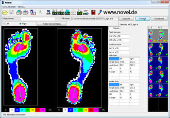 Analysis software - novel footpat® - novel - for podiatry