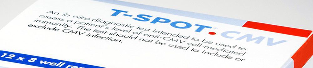 Immunity rapid test - T-SPOT®.CMV - Oxford Immunotec Ltd. - virus / cell