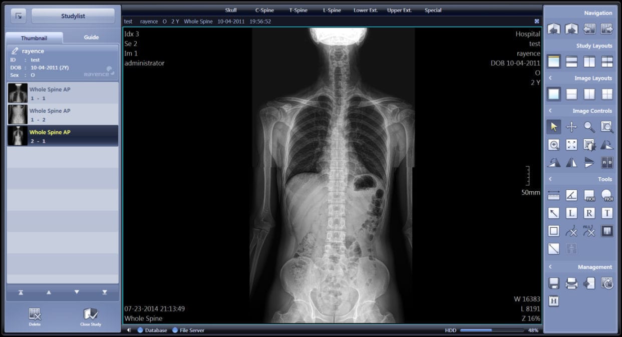 Medical imaging software - Xmaru PACS - Rayence - orthopedic ...