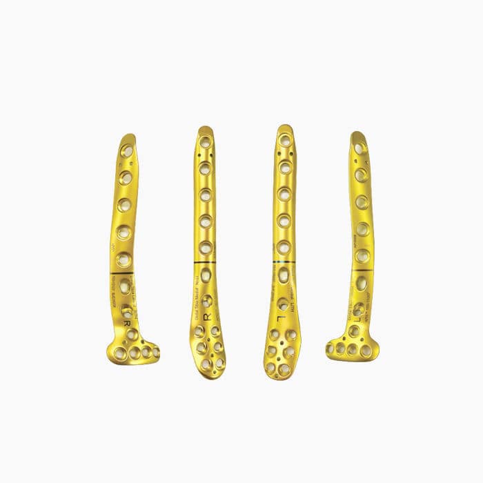 Tibia compression plate - Trifix - TDM - distal / locking / titanium