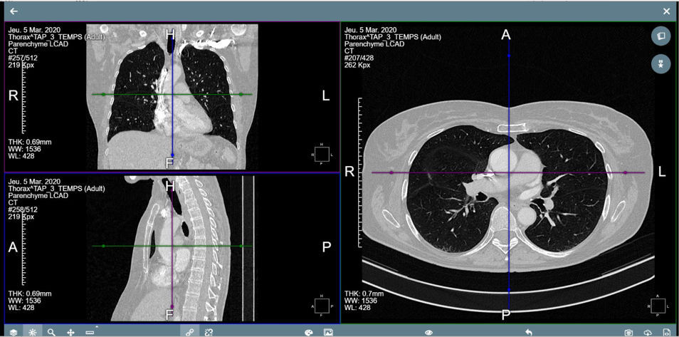Medical imaging RIS - Evolucare Imaging - EVOLUCARE - web-based