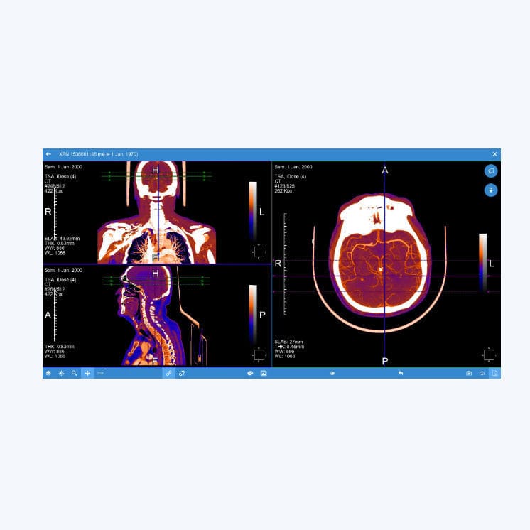 Medical imaging PACS - EVOLUCARE