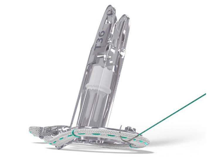 Tricuspid annuloplasty ring - Physio - Edwards Lifesciences