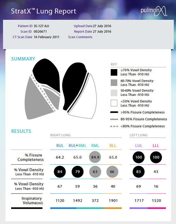 Analysis software - StratX® - pulmonX - reporting / measurement / capture