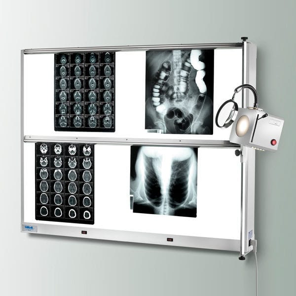2-screen X-ray film viewer - M-NF series - Cablas - white light