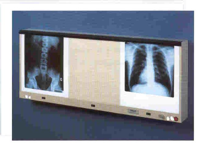 1-screen X-ray film viewer - M-NI series - Cablas - white light
