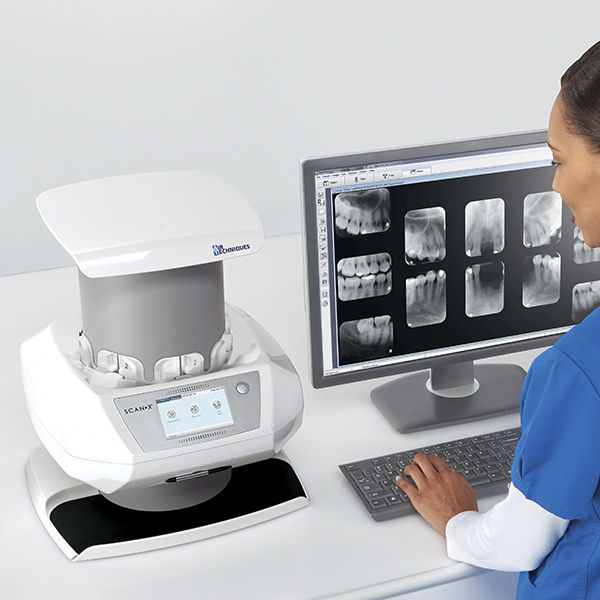 Intraoral phosphor screen scanner - ScanX Intraoral View - Air Techniques