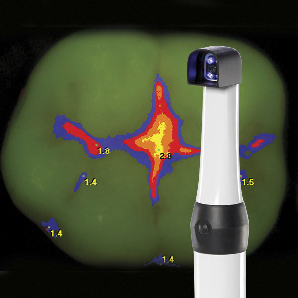 Intraoral camera - CamX Spectra - Air Techniques - digital / fluorescent
