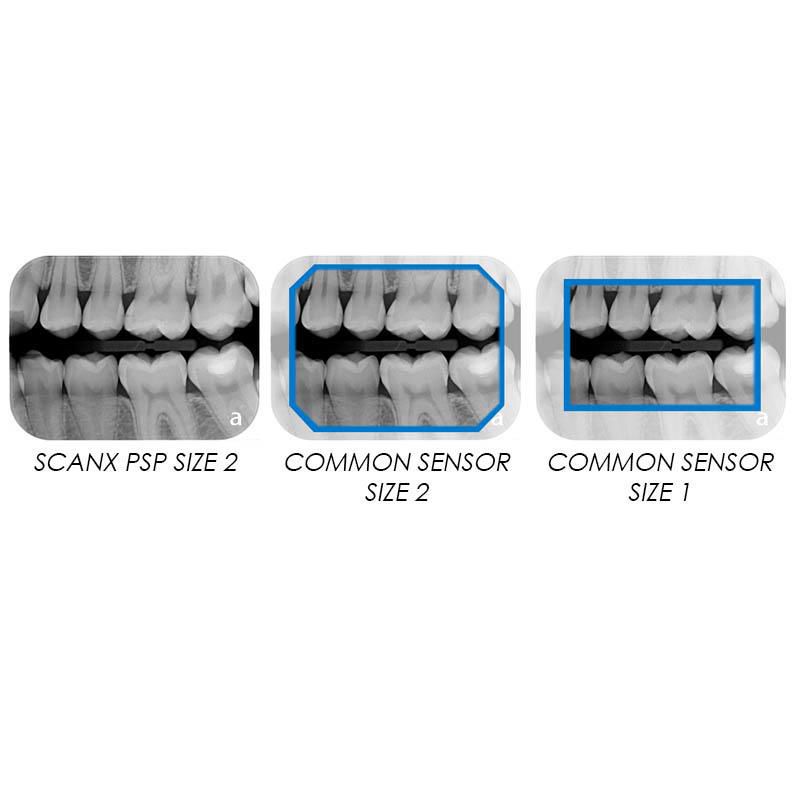 Intraoral phosphor screen scanner - ScanX Swift - Air Techniques - Videos