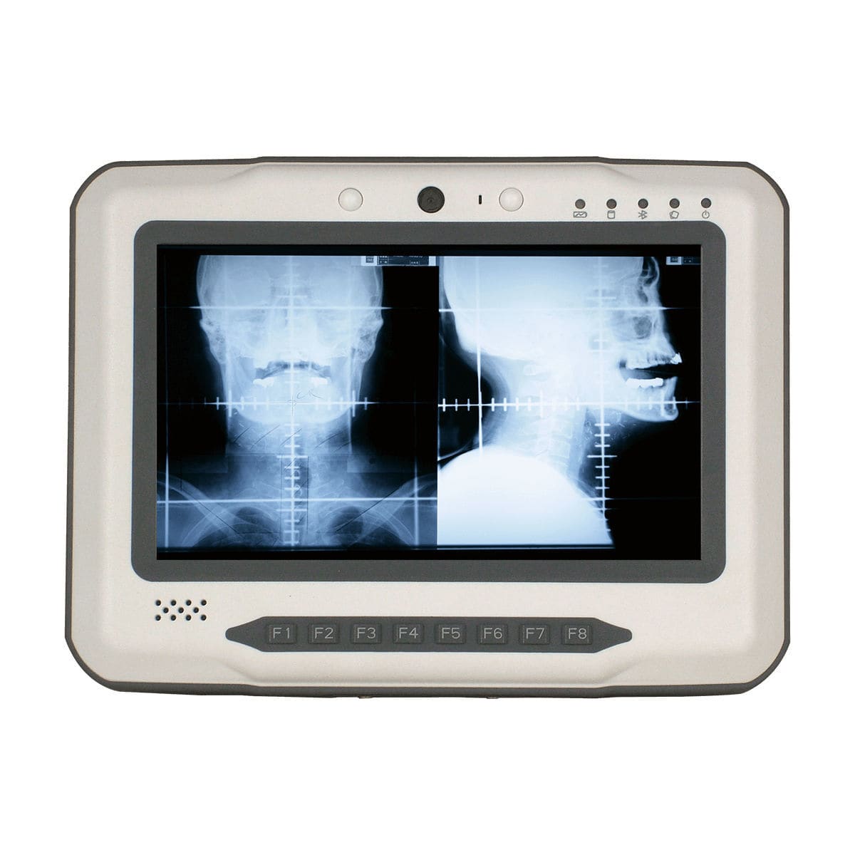 Intel® Atom Z510 medical tablet PC - Gladius G0710 - ARBOR - for ...