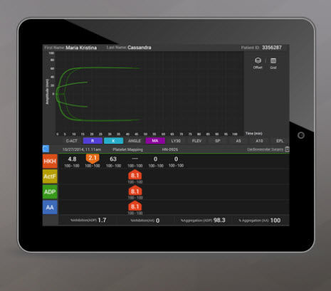 Visualization software / analysis / data management / treatment - TEG ...