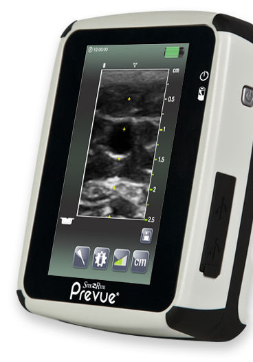 Portable ultrasound system / for anesthetic and intensive care ...
