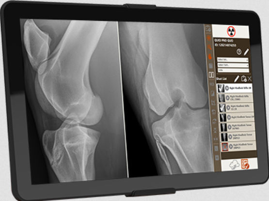 Veterinary X-ray system - NEXT Equine DR™ - Sound - digital / portable
