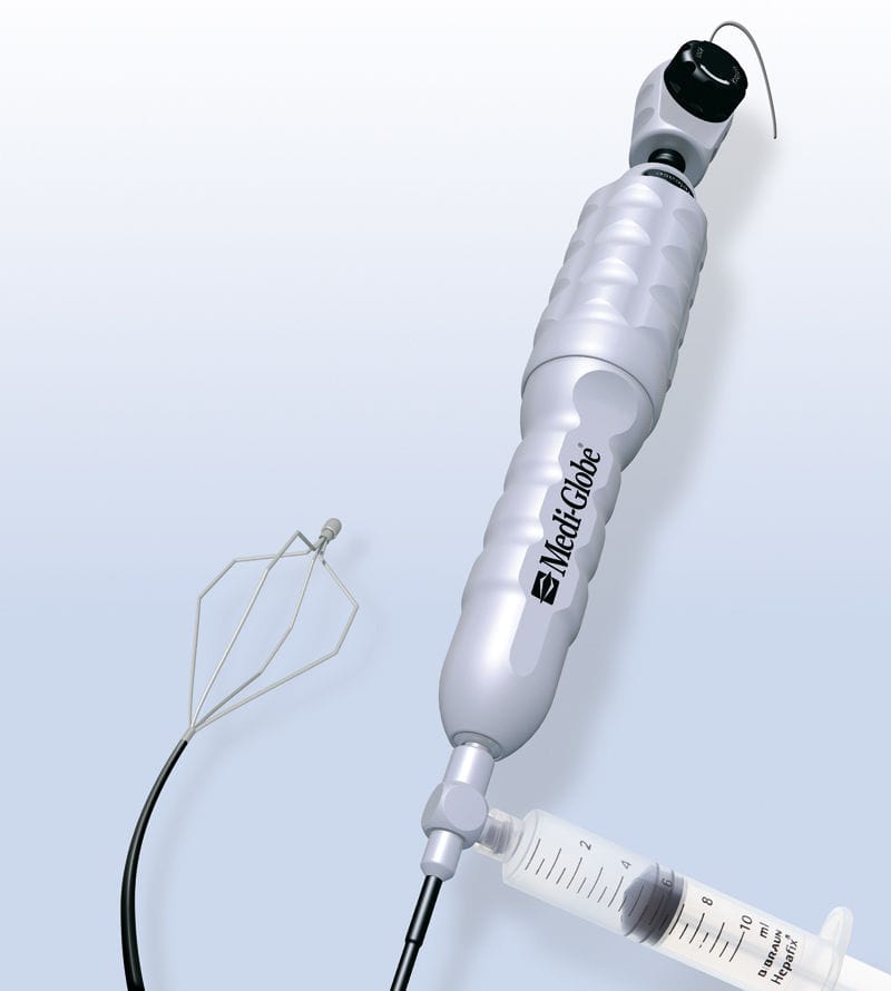 Biliary stone extraction endoscopic basket - StoneBuster® - Medi-Globe ...