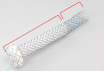 Biliary stent - HANAROSTENT® Biliary Flange Lasso (NC) - M.I Tech