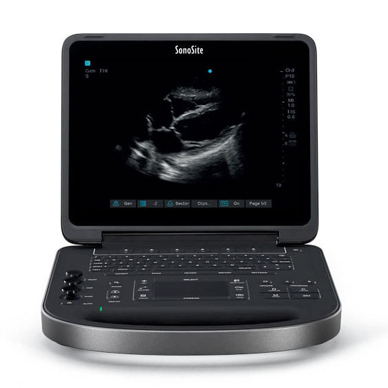 Portable ultrasound system - SonoSite Edgell - Sonosite - for ...