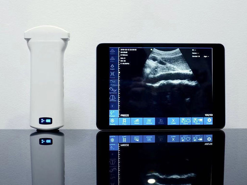 Hand-held ultrasound system - PalmUS - Sonostar Technologies - for ...