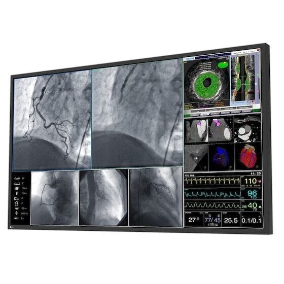 Diagnostic display - CuratOR® LL550W - EIZO GmbH - angiography / 3840 × ...