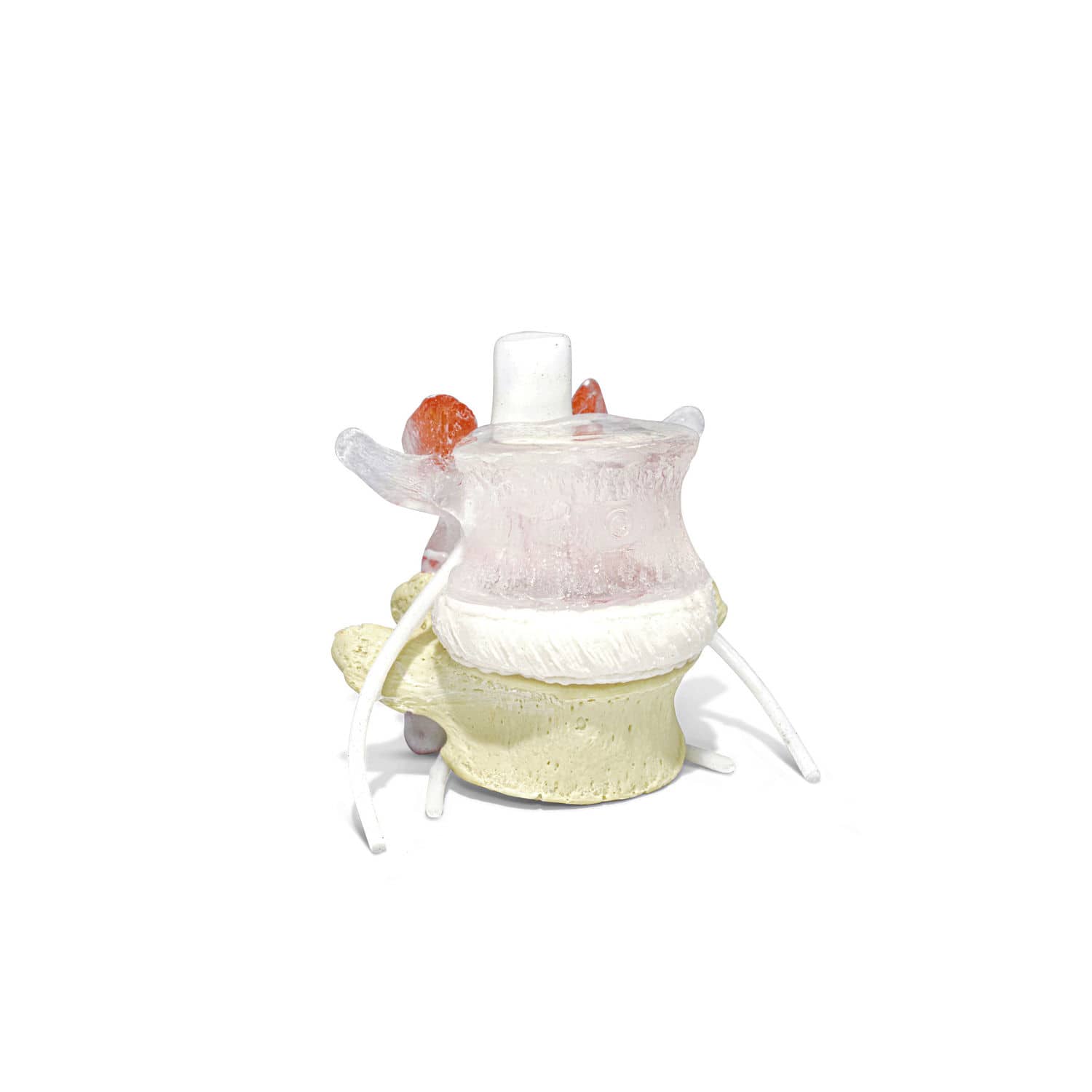 Lumbar vertebra anatomical model - Academic LxH - Dynamic Disc Designs ...