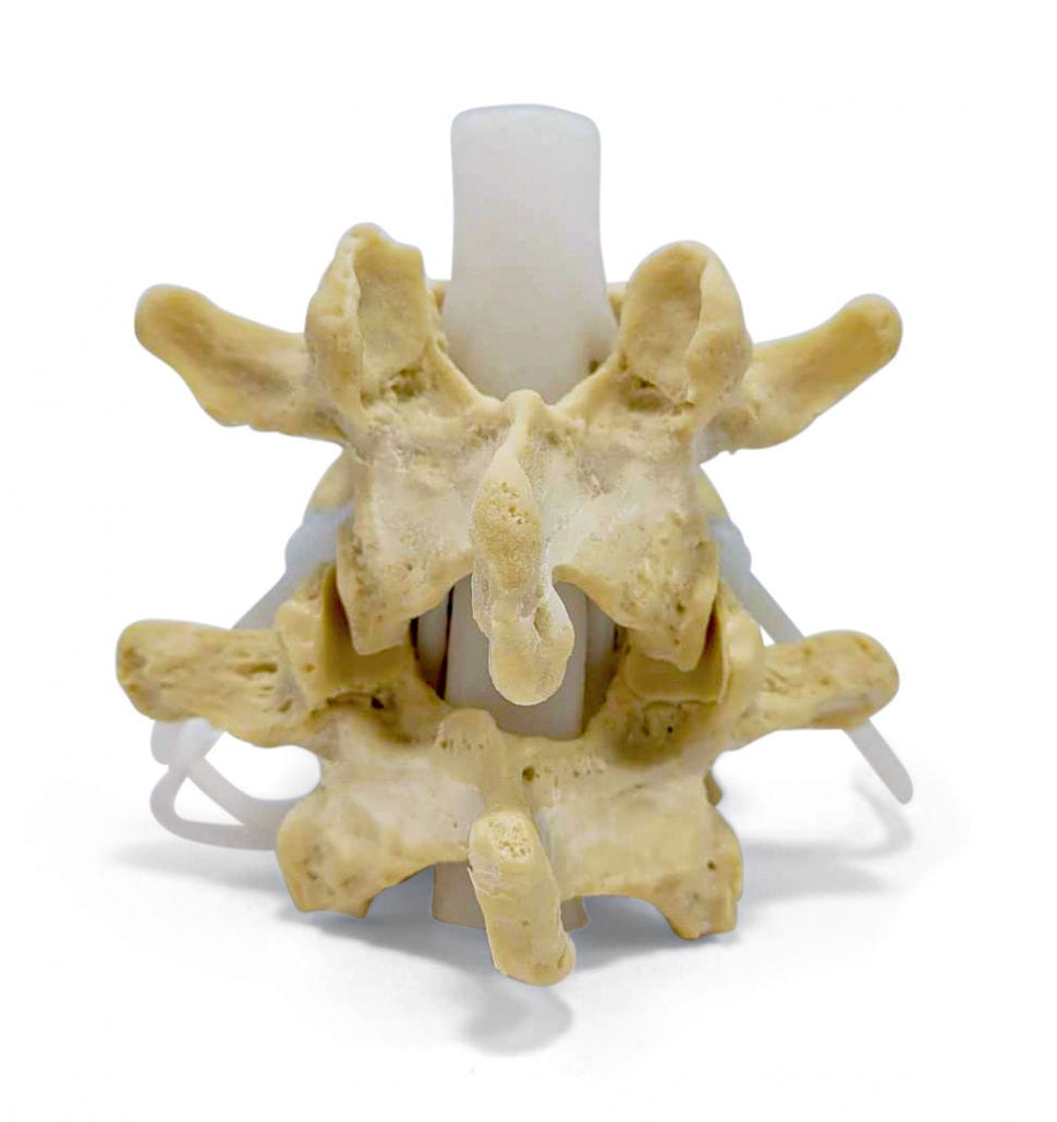 Intervetebral disc model - Classic LxH Dynamic - Dynamic Disc Designs ...
