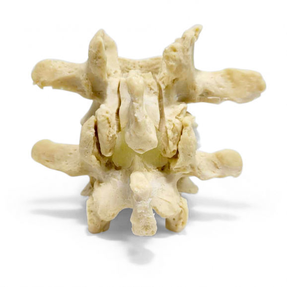 Lumbar model - Dynamic Disc Designs Corp. - surgical / for teaching ...