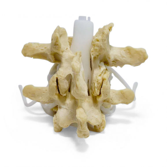 Lumbar model - Dynamic Disc Designs Corp. - spinal / surgical / for ...