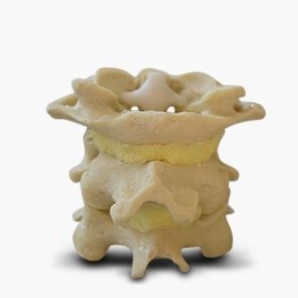 Spine anatomical model - Dynamic Disc Designs Corp. - cervical / for ...