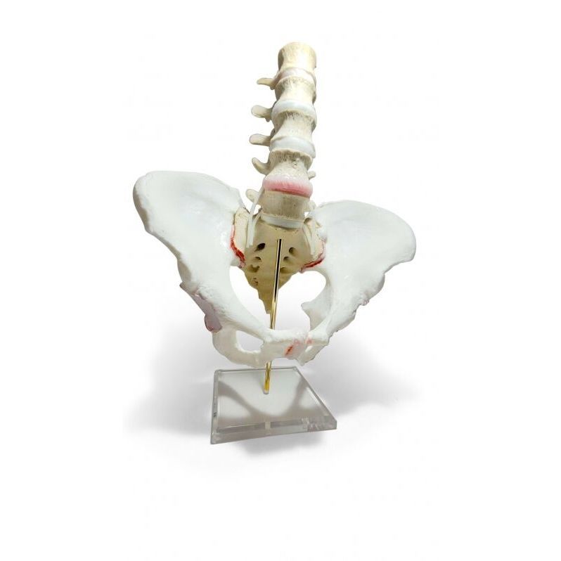 Pelvis model - L1 - Dynamic Disc Designs Corp. - intervertebral disc ...