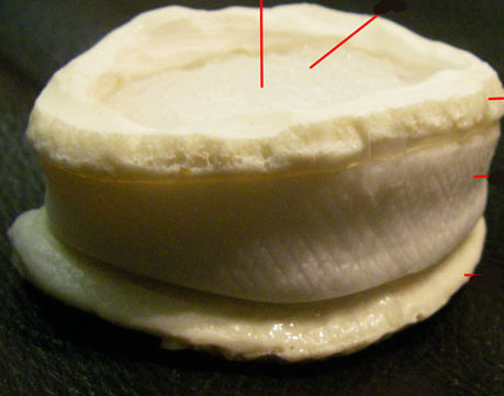 Intervetebral disc model - Dynamic Disc Designs Corp. - for teaching