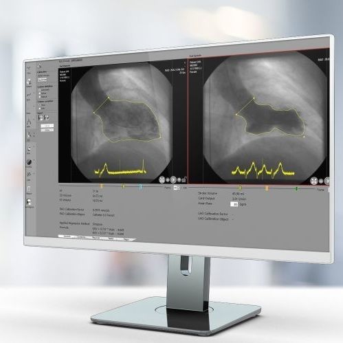 Analysis software - RVA - Pie Medical Imaging - reporting / calibration ...