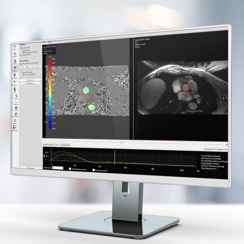 Analysis software - Pie Medical Imaging - reporting / visualization ...