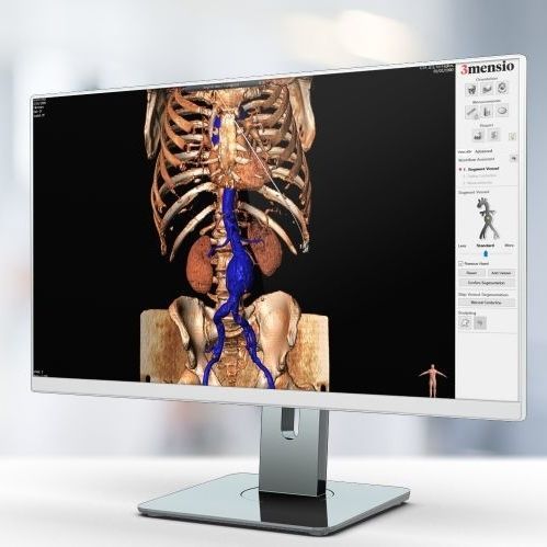 Image analysis software - Pie Medical Imaging - planning / treatment ...