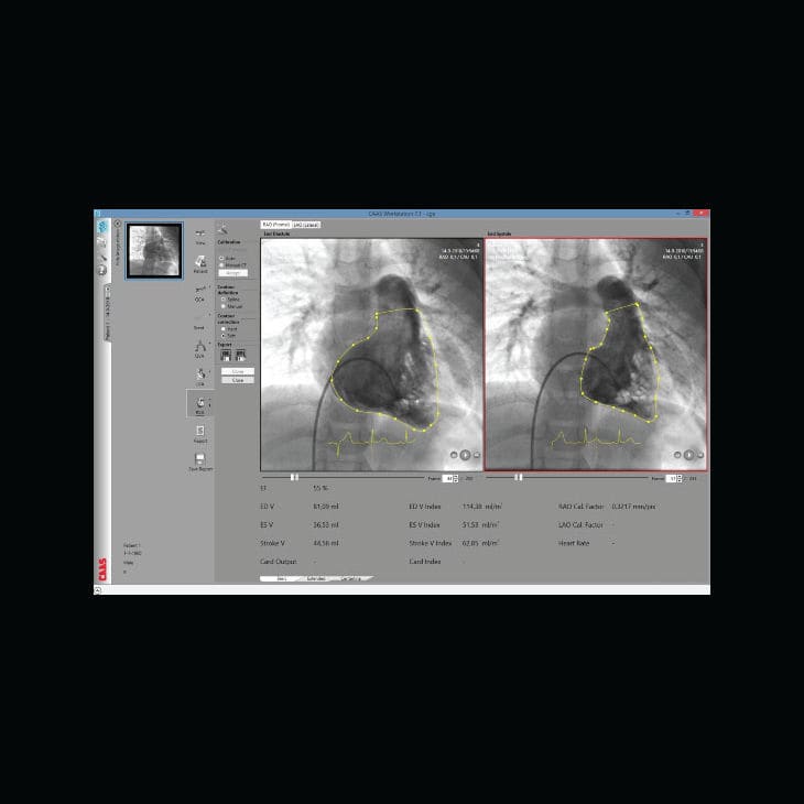 Medical imaging software - CAAS RVA - Pie Medical Imaging - for ...