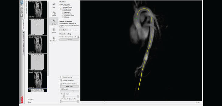 3D viewing software - CAAS MR 4D Flow - Pie Medical Imaging - analysis ...