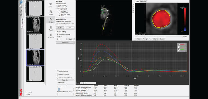 3D viewing software - CAAS MR 4D Flow - Pie Medical Imaging - analysis ...