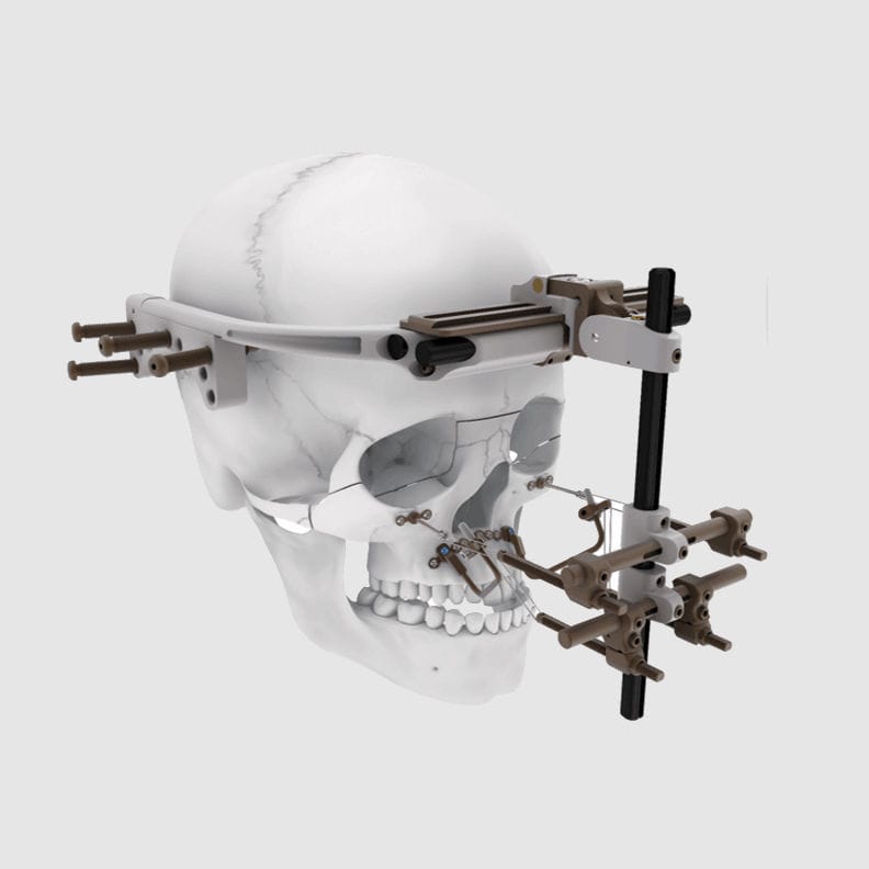 Maxillary distractor - Depuy Synthes - external / pediatric