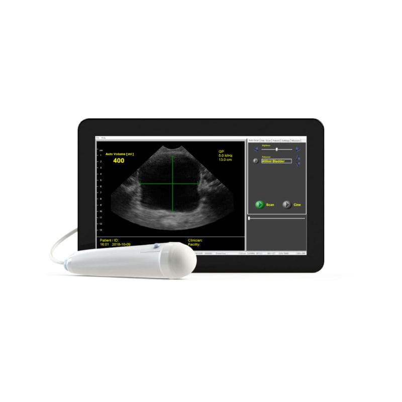 Hand-held bladder scanner - ViewBladder 10 - Interson