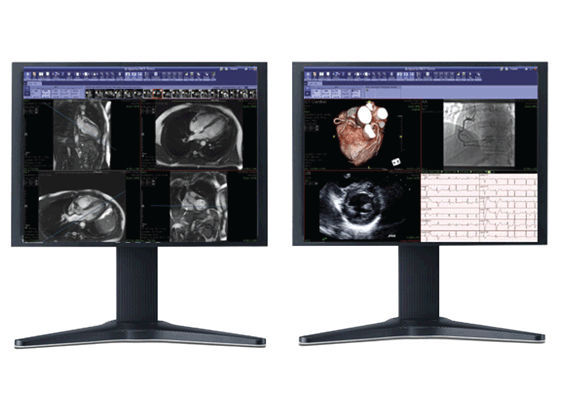 3D viewing software - iNtuition REVIEW - TeraRecon - diagnostic ...