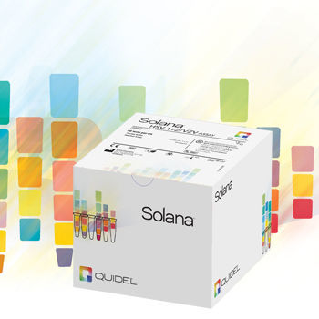 Herpes simplex virus assay kit - Solana® - Quidel - HSV / VZV ...