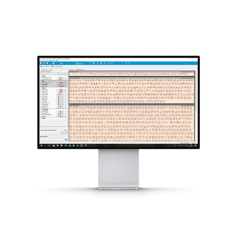 Image analysis web application - Cellavision AB - visualization ...