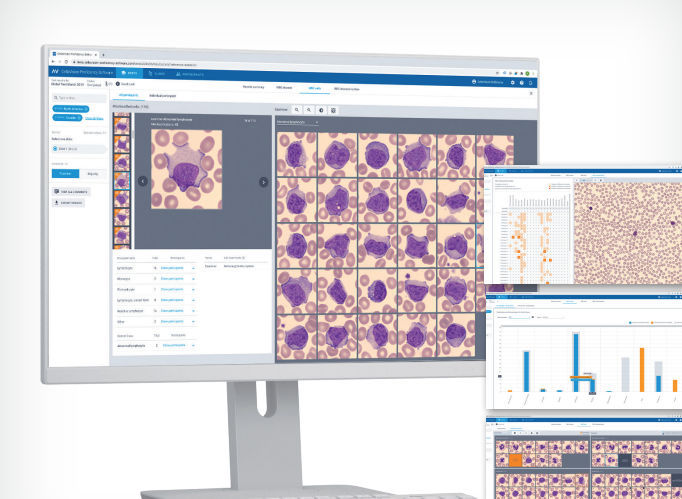 Image analysis software - Cellavision AB - management / diagnostic ...